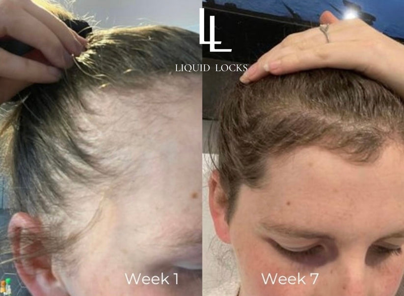 Liquid Locks Hair Growth Serum